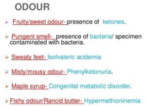 Sweet Smelling Urine - Causes, Diabetes, What Does it Tell?