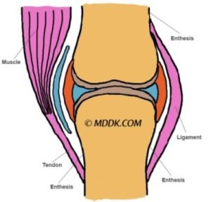 Enthesopathy - What Is, Region, Ankle, Causes, Symptoms, Diagnosis